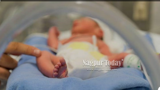 900-gram baby undergoes rare heart surgery at AIIMS Nagpur, survives ...